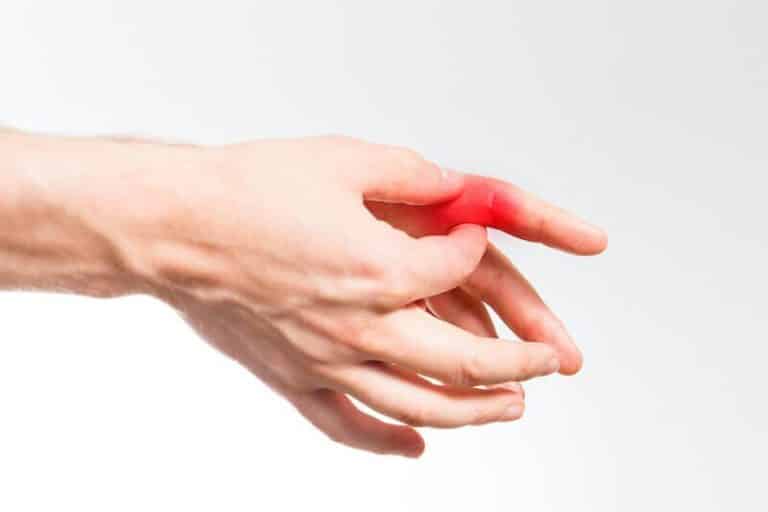 Pathologie des doigts de la main et pathologie du pouce | Pr Eric Roulot