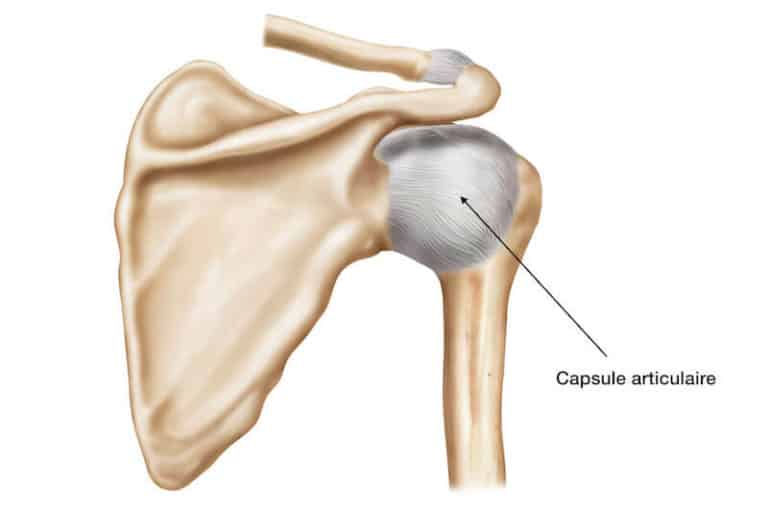 Comprendre la maladie de la capsulite rétractile de l'épaule - Stress ...
