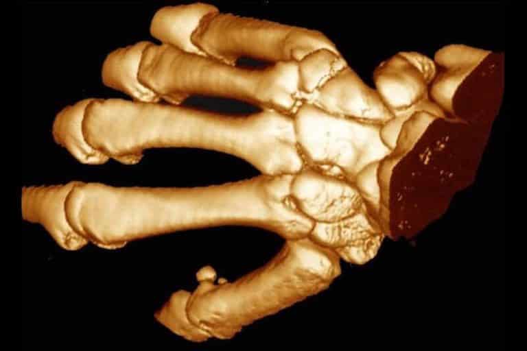 Anatomie de la main et du poignet - Articulations, os du carpe, tendons ...