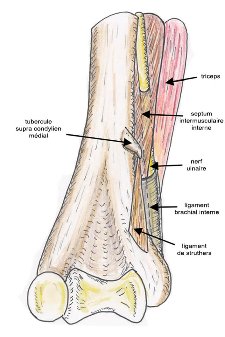 Nerf ulnaire au coude (nerf cubital) - Trajet, compression, libération | Pr Eric Roulot